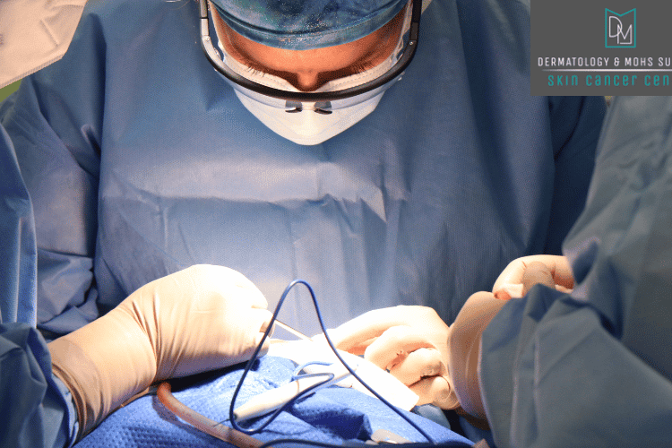Mohs Surgery Archives - Dermatology and Mohs Surgery Skin Cancer Center