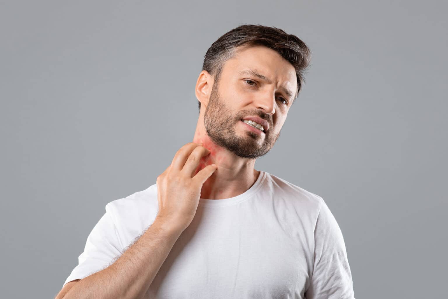 Eczema And Atopic Dermatitis: All You Need To Know