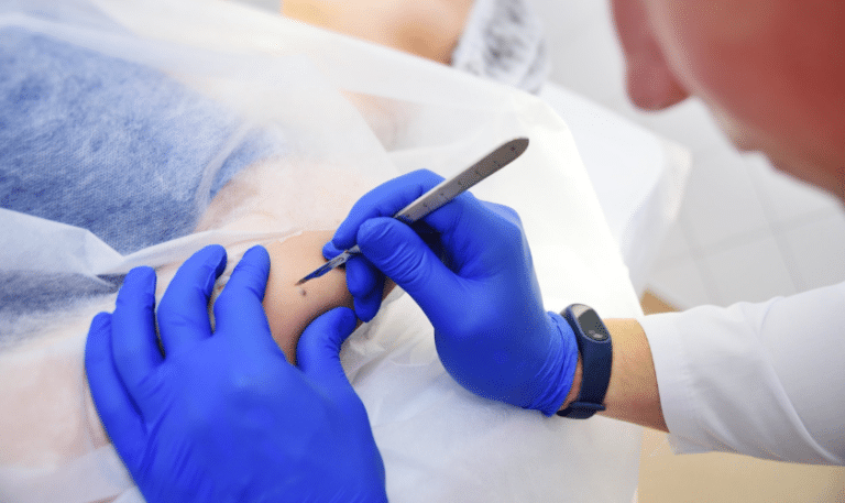 Revolutionizing Skin Health: The Impact of Technology in Surgical ...